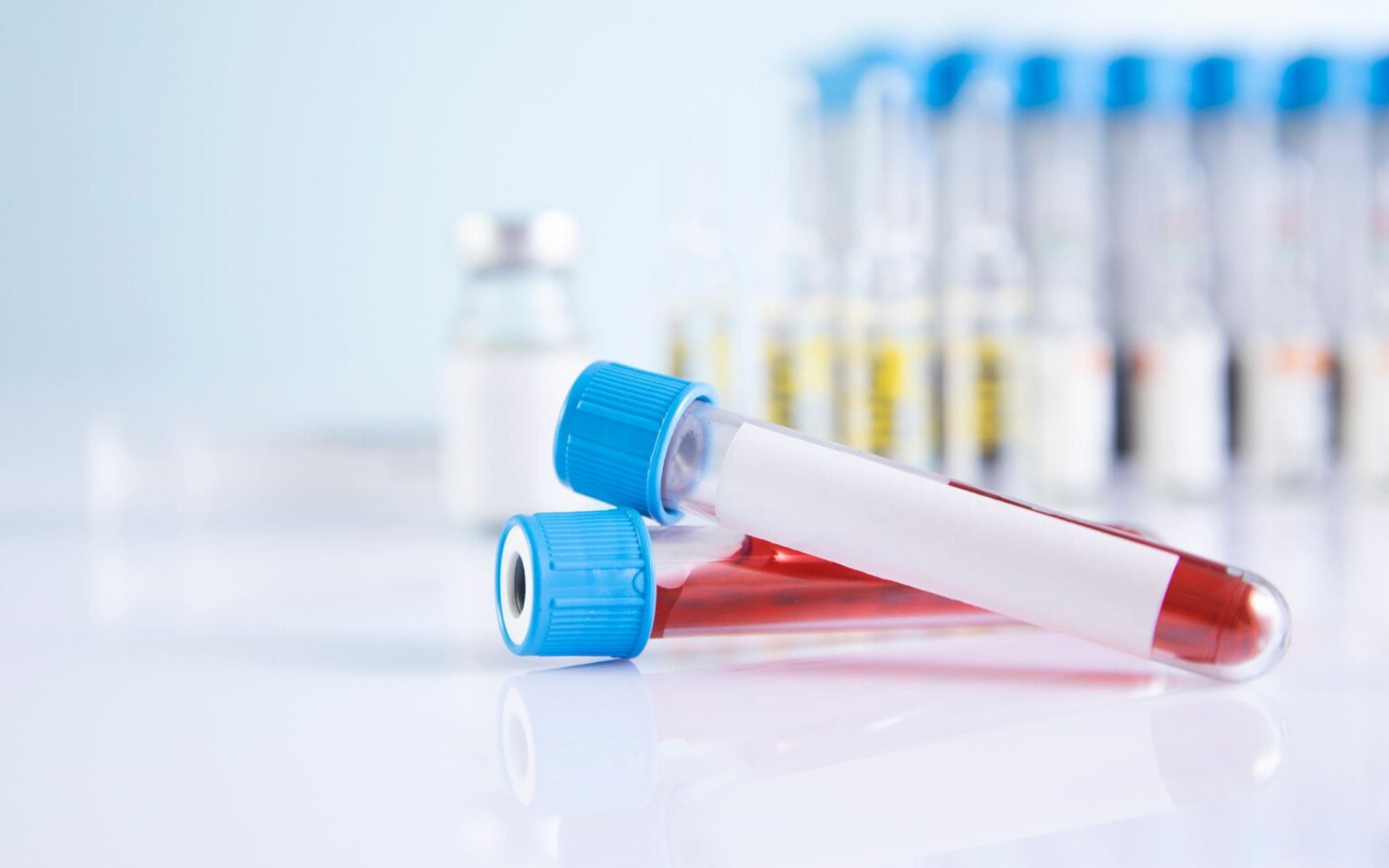 Blood Tests | Medical Tests London