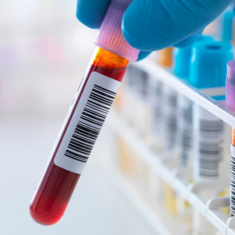 Clotting Screen Blood Test London