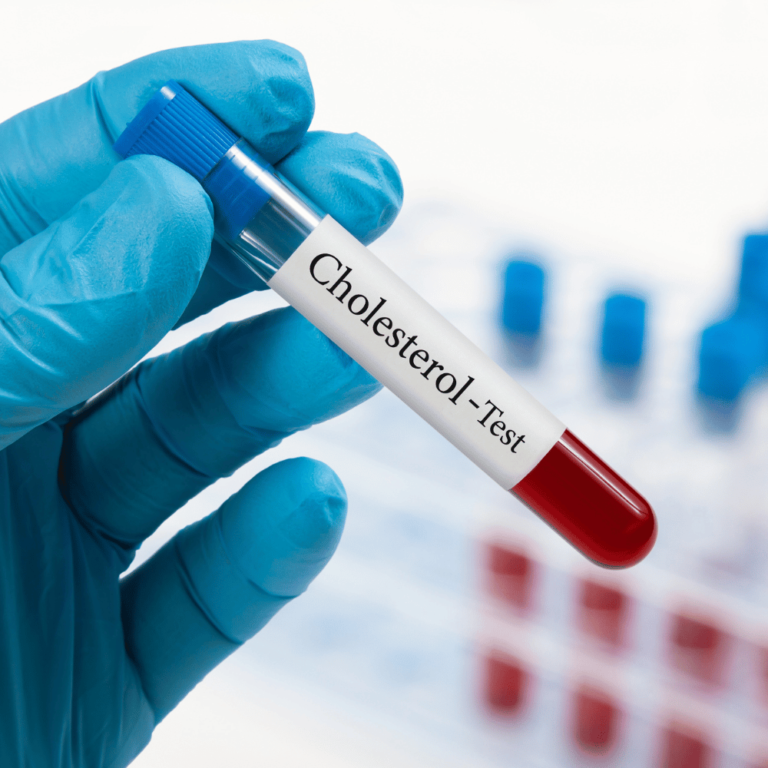 Clotting Screen Blood Test London