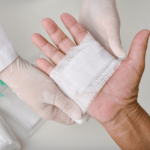 Remove Splinters London | Get Deep Splinter Out