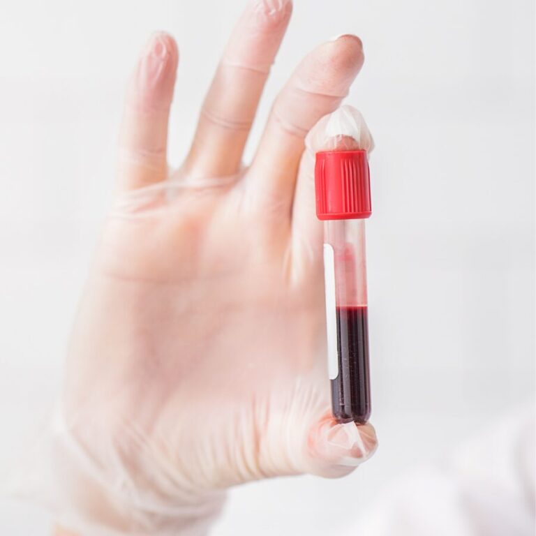 Iron Blood Test London | Check Iron Levels